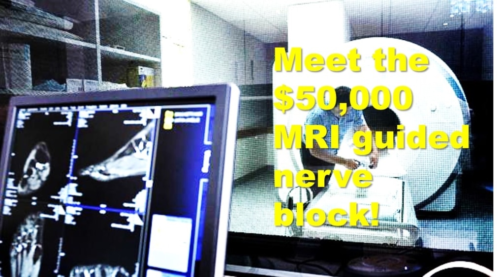 MRI nerve injections review