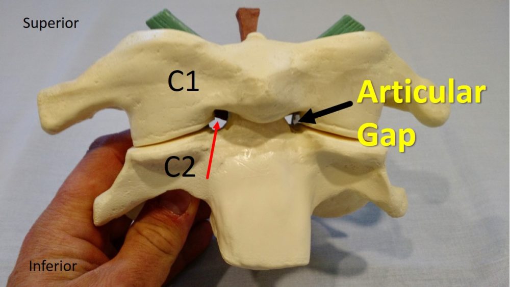 alar ligament treatment