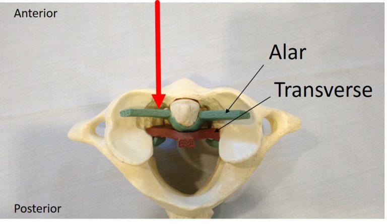 alar ligament treatment