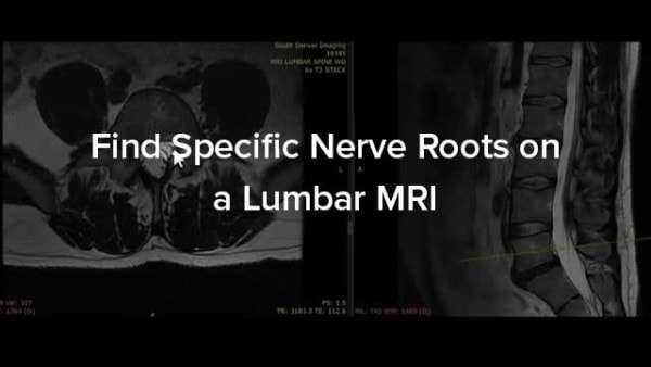How to Read Your MRI - Regenexx