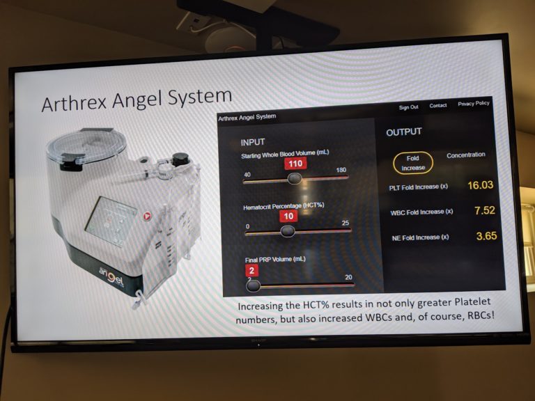 arthrex angel review is this the holy grail of bedside machines