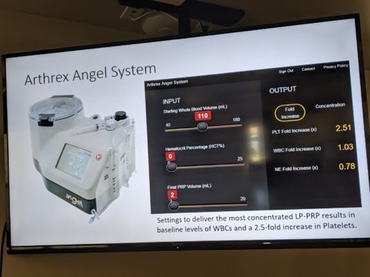 arthrex angel review is this the holy grail of bedside machines