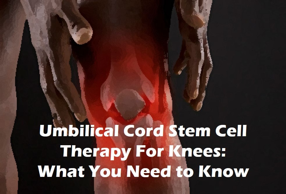 Umbilical Cord Stem Cell Therapy for Knees - Regenexx Blog