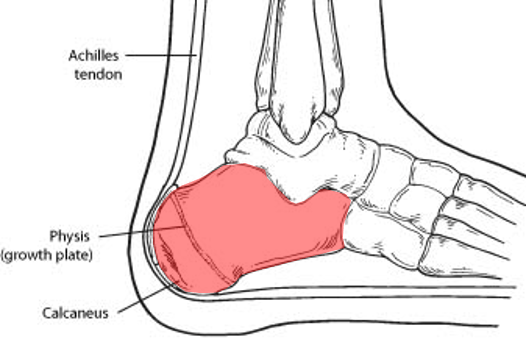 Pain In The Back Of The Heel pain In The Back Of The Heel Pain In The Back Of The Heel pain In The Back Of The Heel