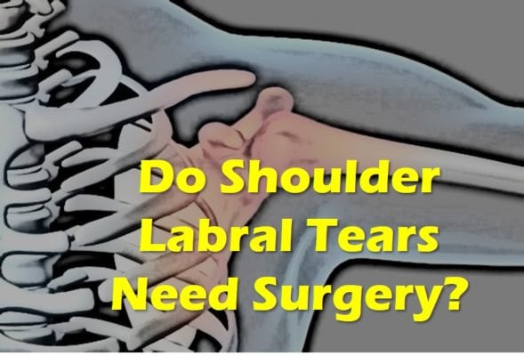 do shoulder labral tears need surgery