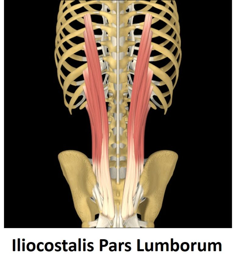 Treating an L5-S1 Disc Herniation: A Case Study - Regenexx