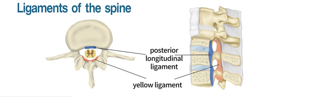 Treating an L5-S1 Disc Herniation: A Case Study - Regenexx