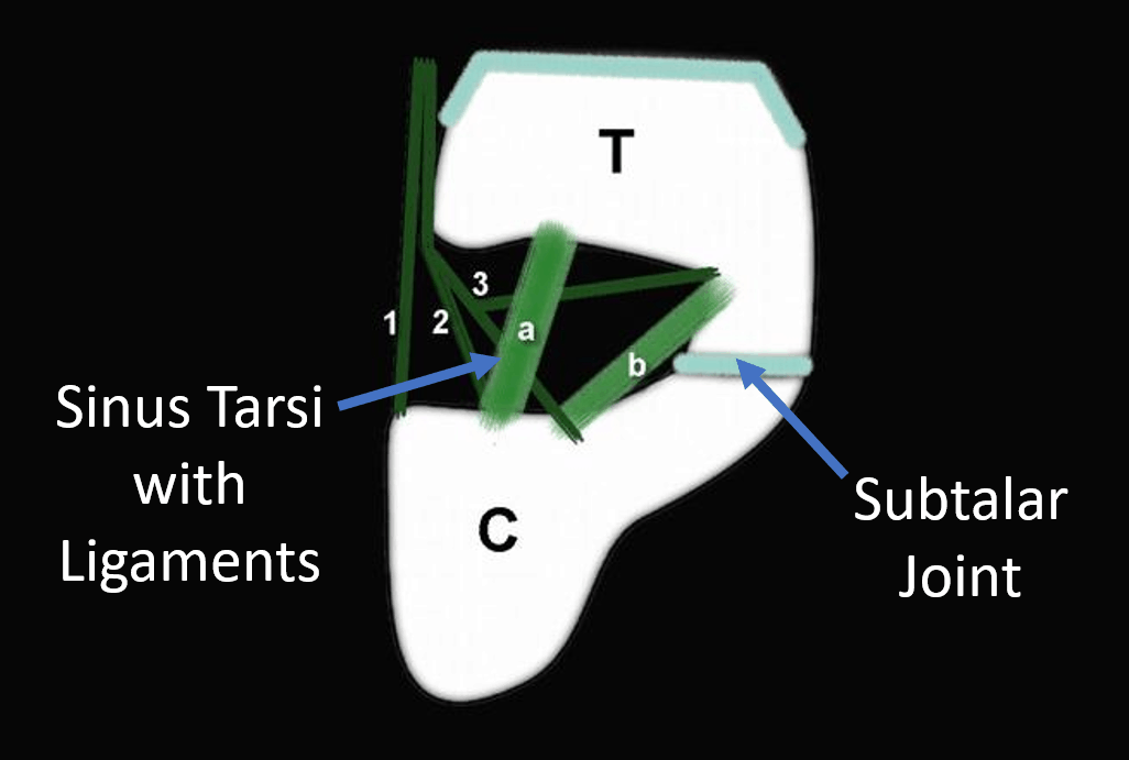 Telemedicine Patient Diaries: Ankles, Backs, and Necks! - Regenexx