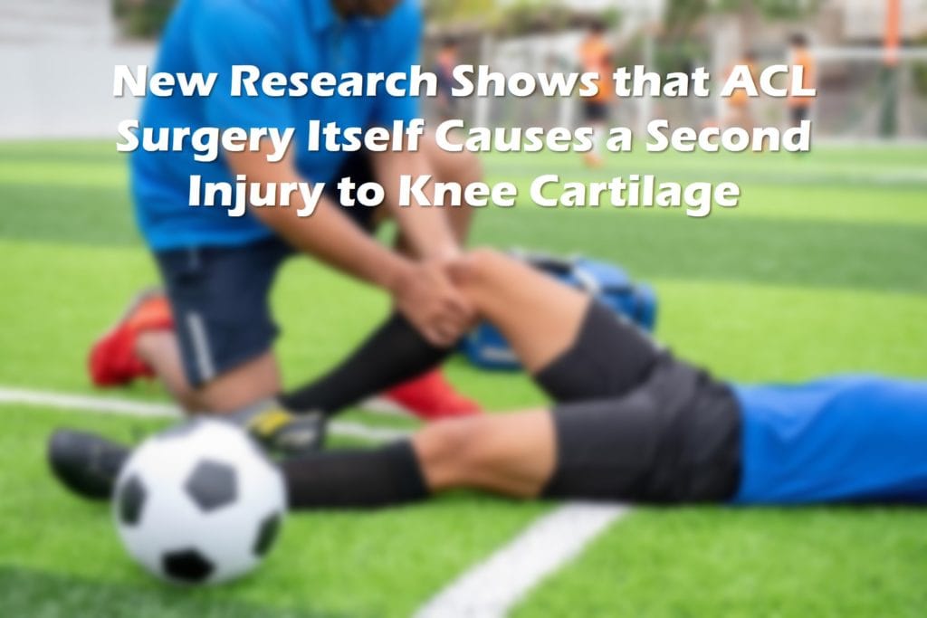 ACL Reconstruction Surgery Is a Second Hit to the Cartilage: Time to ...