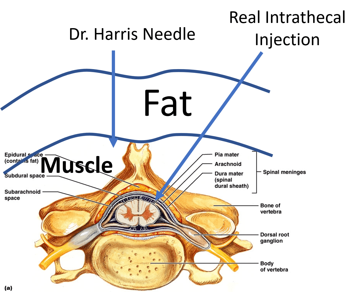 Brimhall Wellness Stem Cell Course: A Review - Regenexx