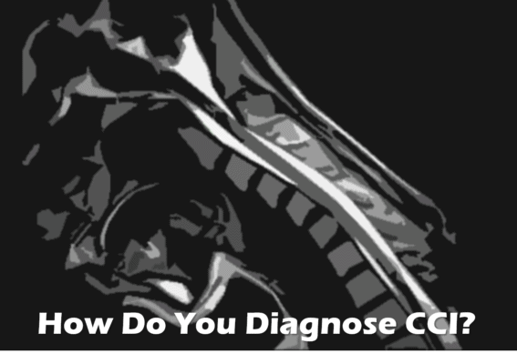 Making the Diagnosis of Craniocervical Instability - Regenexx