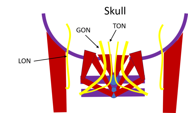 The Nerves at the Back of Your Head and Headaches - Regenexx