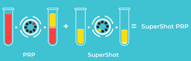 What Is Supershot PRP? - Regenexx