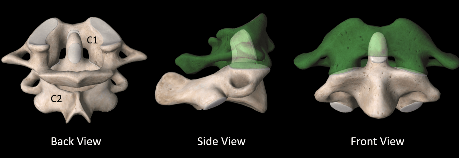 What Is Cervical Medullary Syndrome? - Regenexx