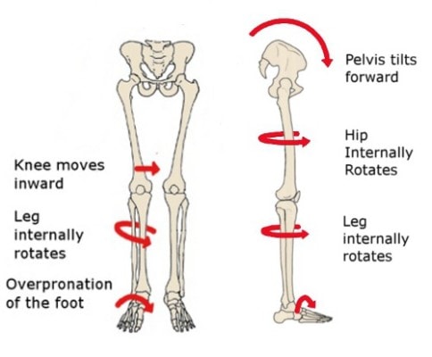 Have Kneecap Pain? Exercise Your Hips! - Regenexx