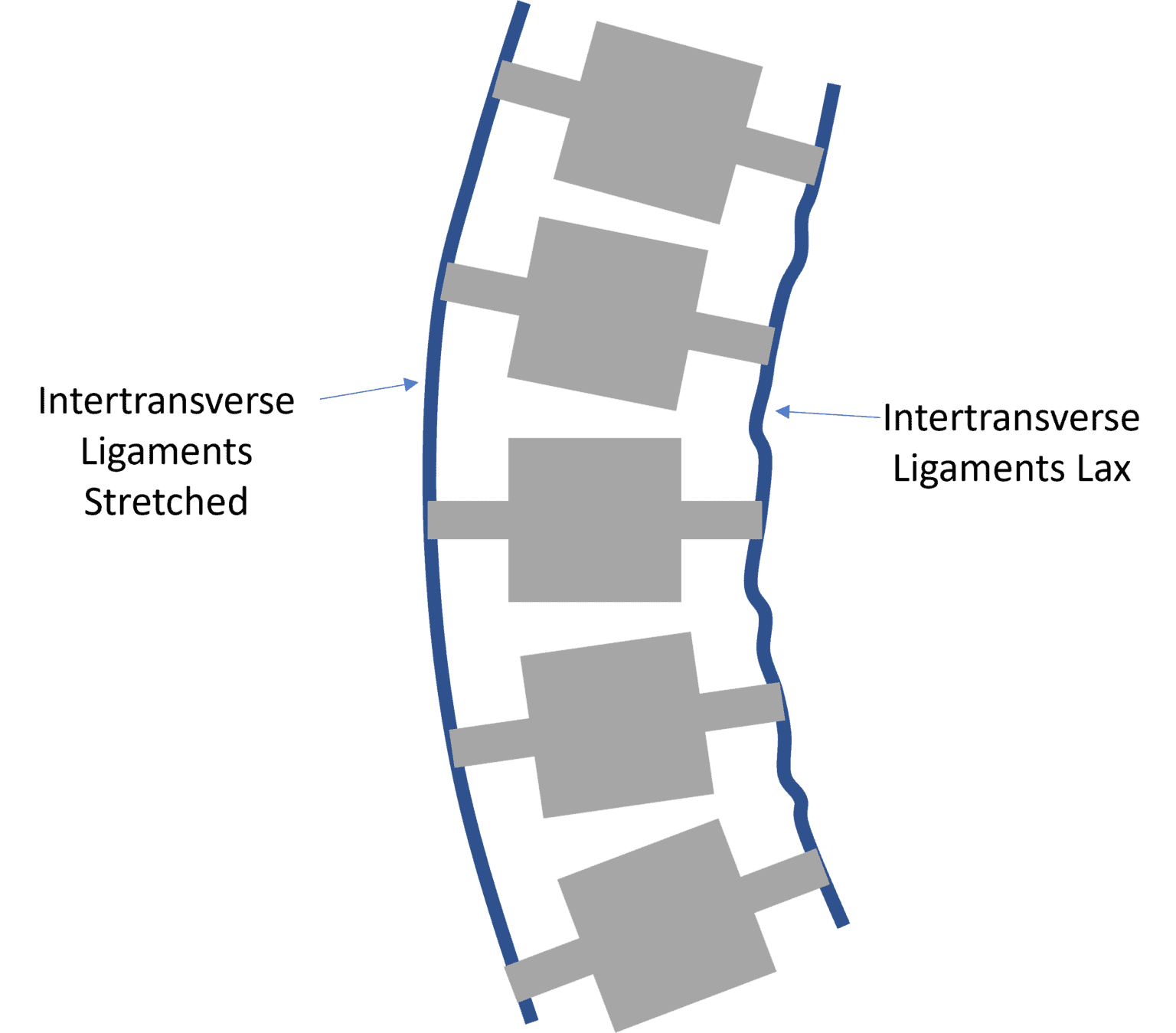 What Are the Intertransverse Ligaments? - Regenexx
