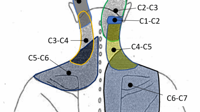 Facet Joint Pain and Treatment Insights - Regenexx Blog