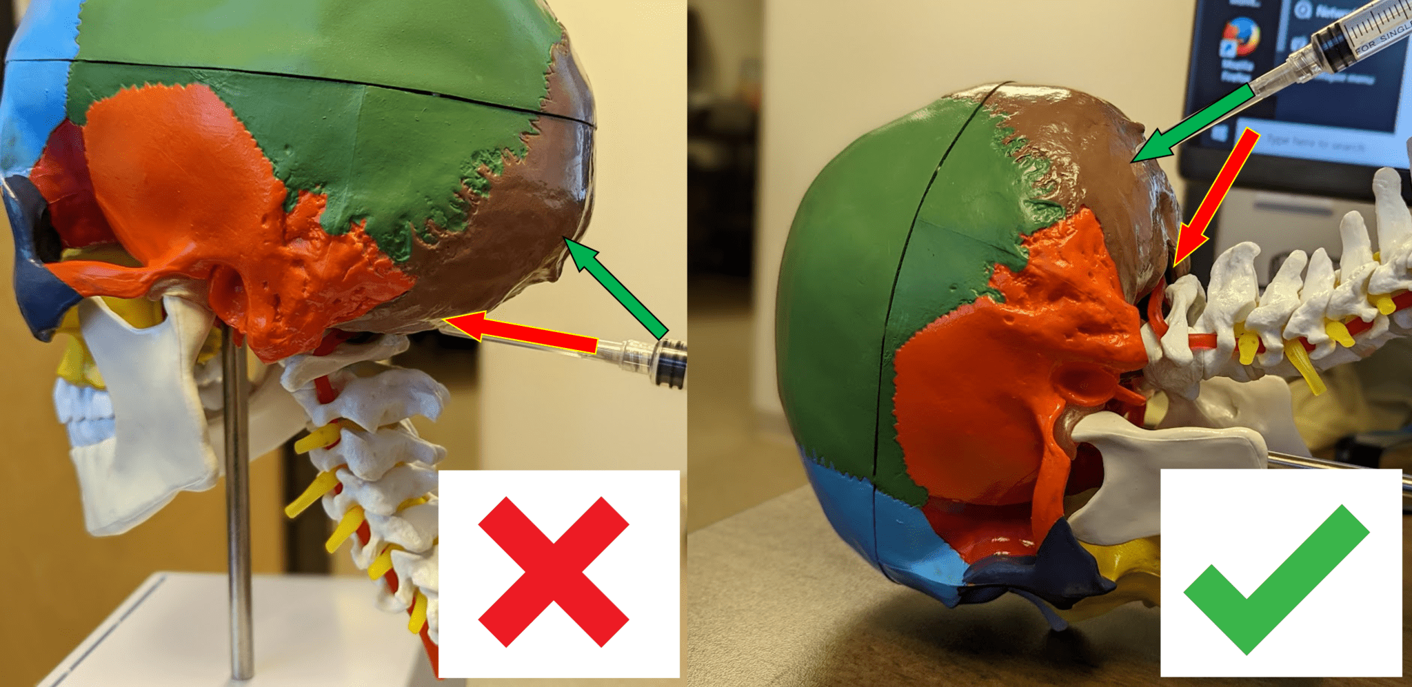 The Dahlia Center and the Travelling "Stem Cell" Road Show - Regenexx