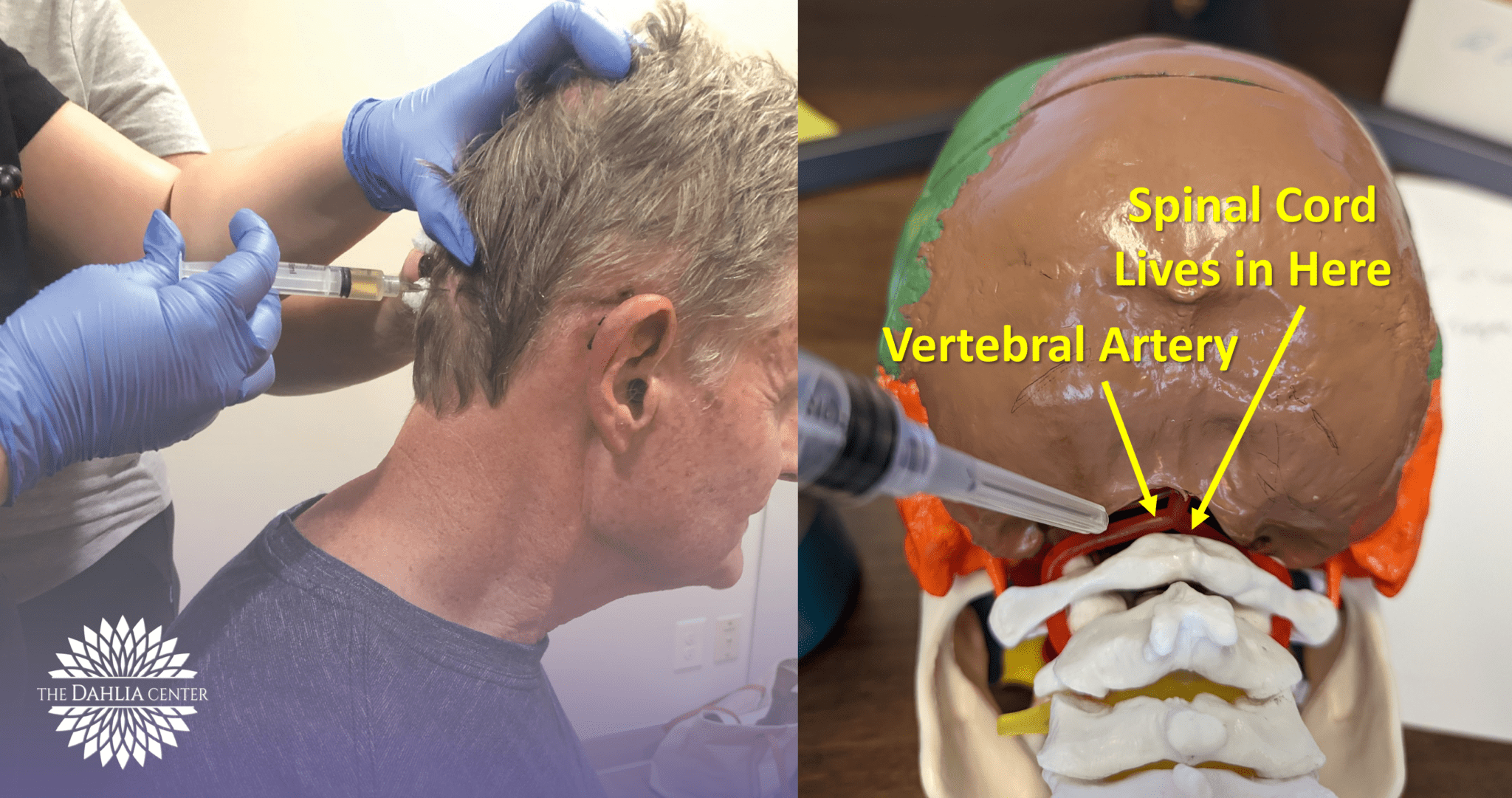 The Dahlia Center and the Travelling "Stem Cell" Road Show - Regenexx