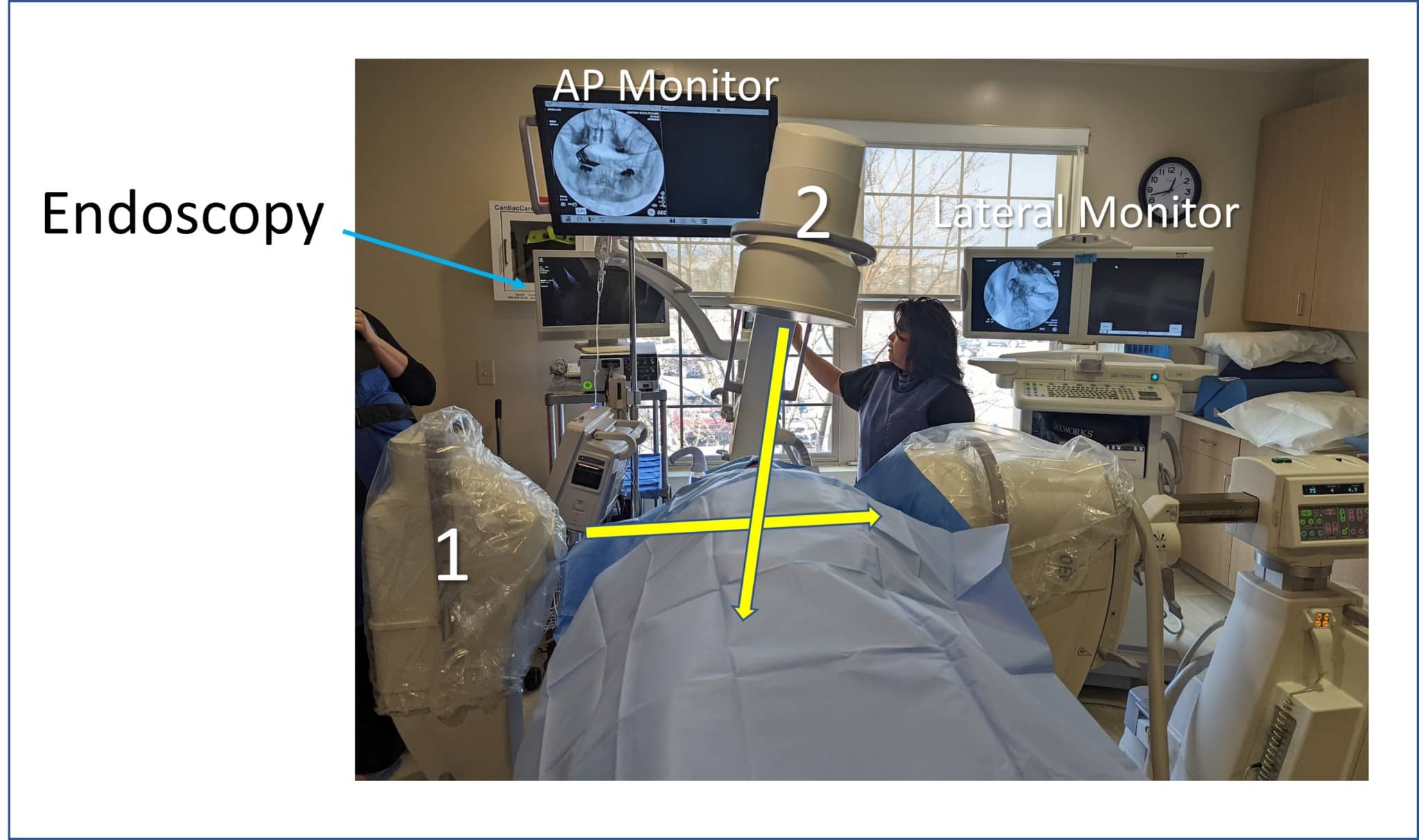 What Dual Axis C-arm Fluoroscopy Can Teach Us About Image Guidance ...
