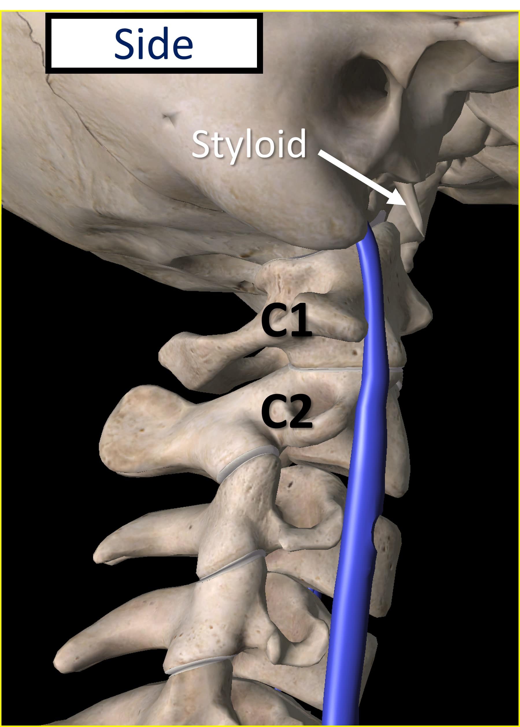 What is Intracranial Hypertension? What Does It Have to Do with the ...