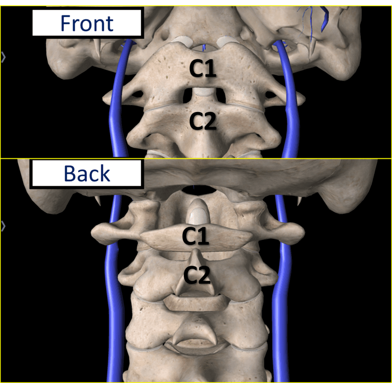 What is Intracranial Hypertension? What Does It Have to Do with the ...