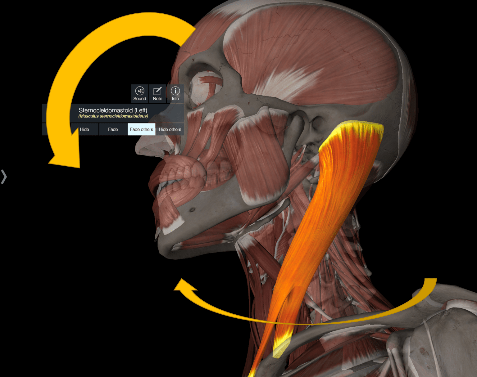 Sternocleidomastoid Syndrome: What You Need to Know - Regenexx