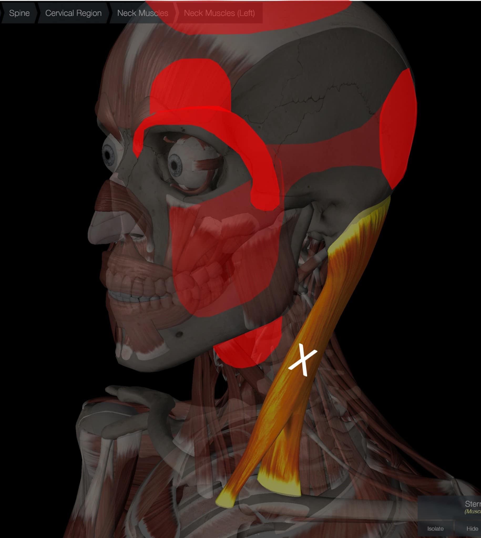 Sternocleidomastoid Syndrome: What You Need to Know - Regenexx