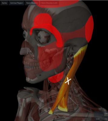 Sternocleidomastoid Syndrome: What You Need to Know - Regenexx