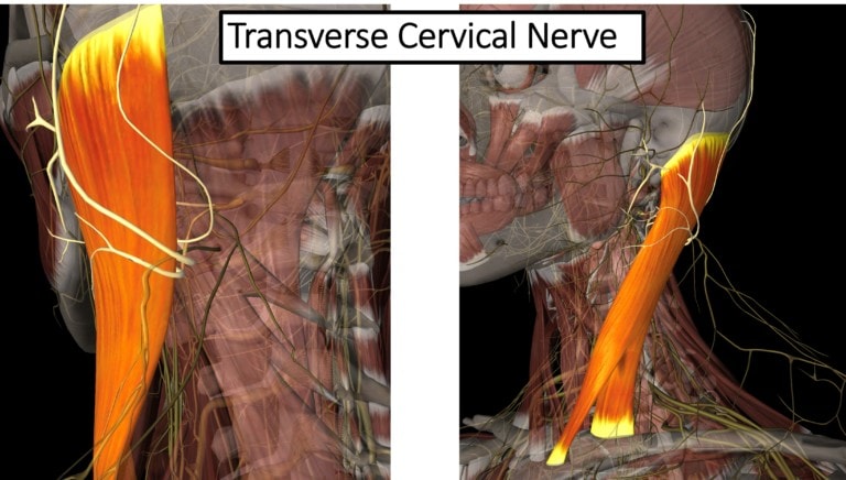 Sternocleidomastoid Syndrome: What You Need to Know - Regenexx