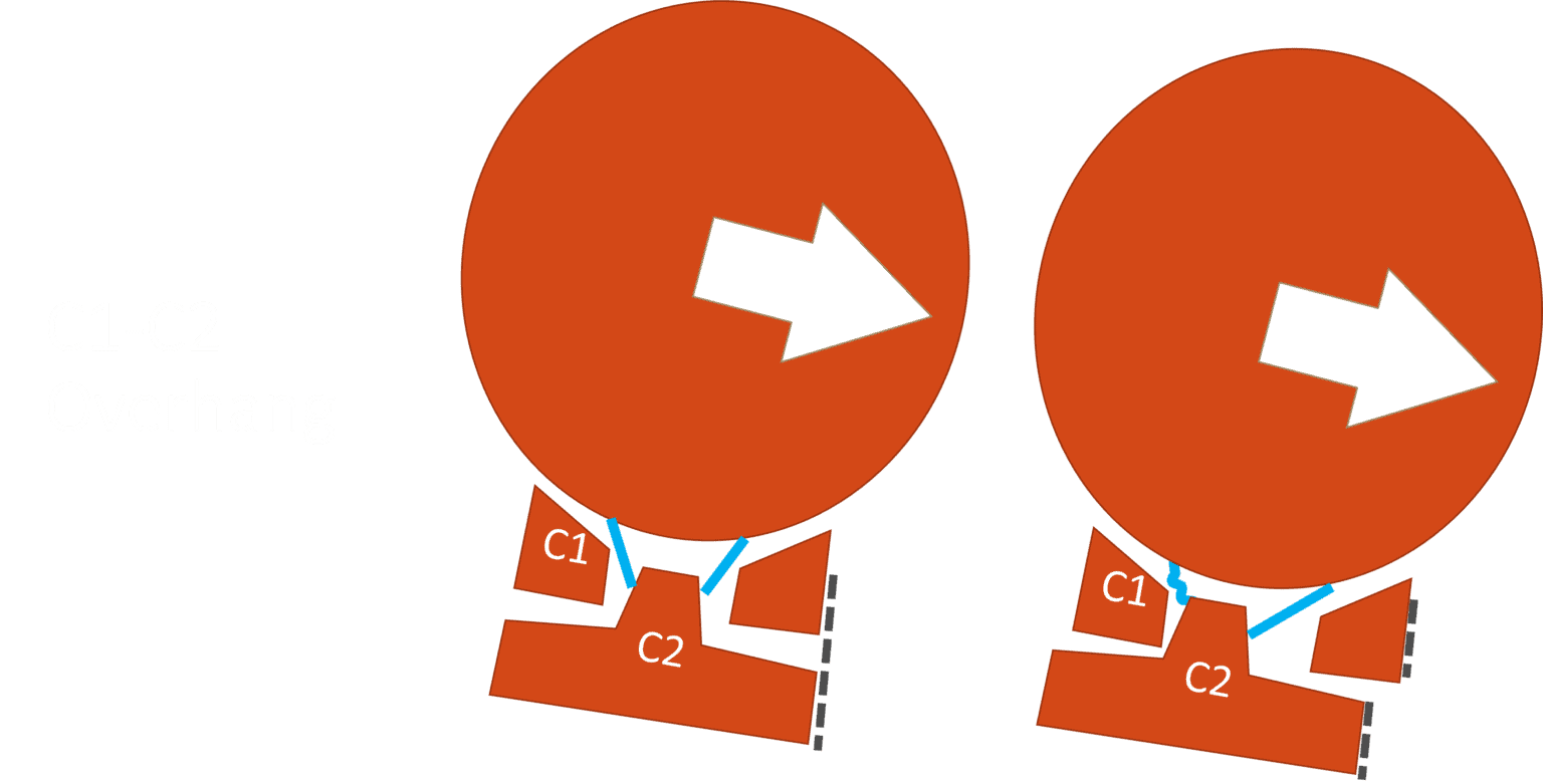 Which Ligament Allows for Excessive C1-C2 Overhang? - Regenexx