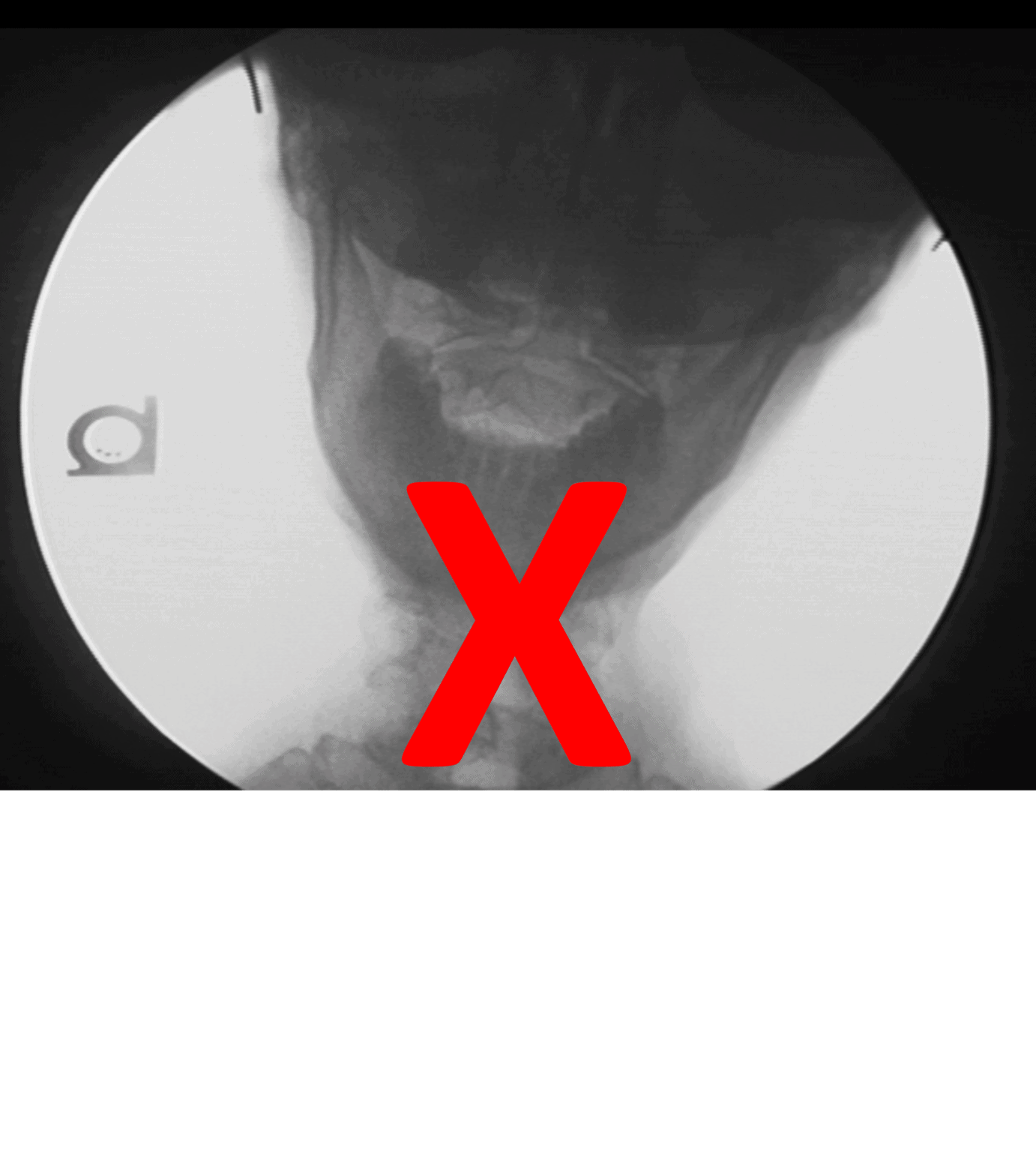 Radiology Instructions for X-ray Based CCI Imaging - Regenexx