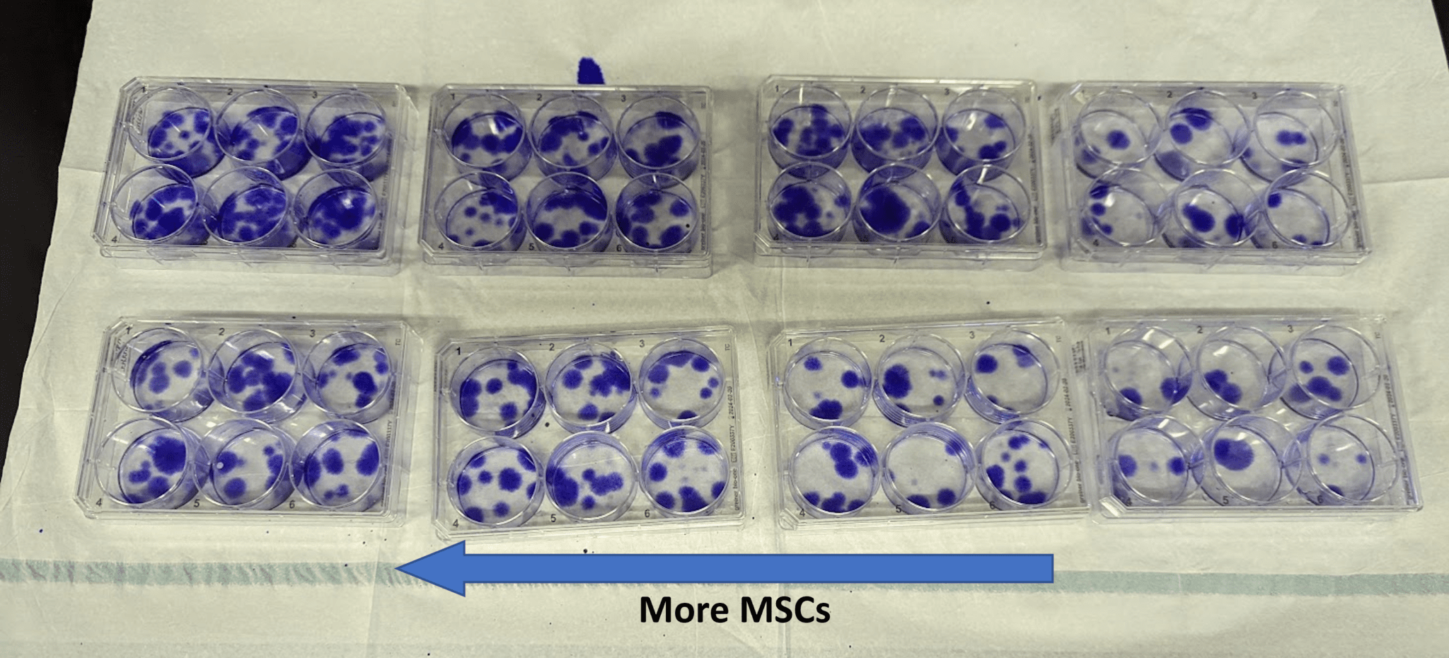 CFU-f 101: To Be an Orthobiologics Expert You MUST Learn This - Regenexx