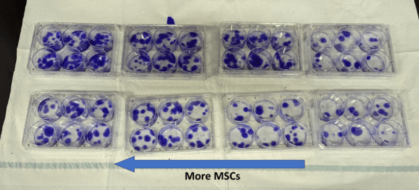 CFU-f 101: To Be an Orthobiologics Expert You MUST Learn This - Regenexx