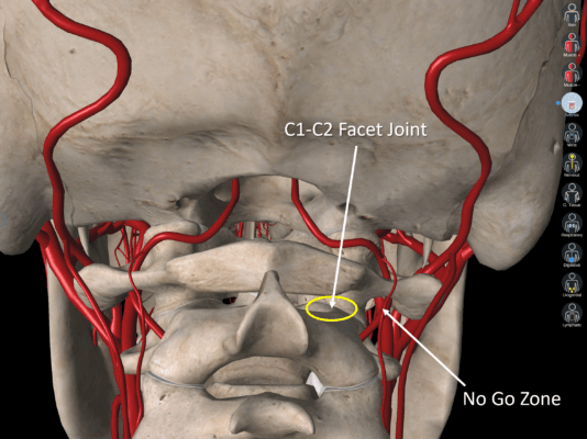 Injecting the C1-C2 Facet Joint Under Ultrasound: A PA with a Scary Big ...