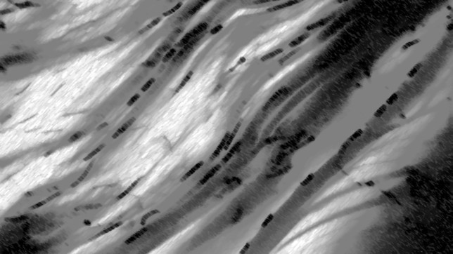 Ligament Tear Treatments and Insights - Regenexx Blog