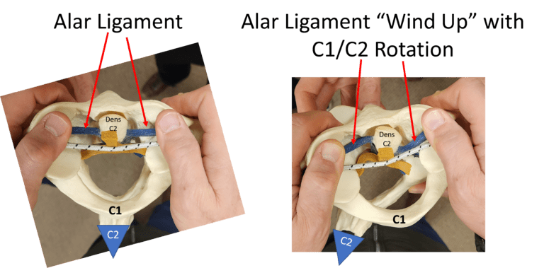 How Does the Body Stabilize the C1-C2 Joint? The Role of the Alar ...