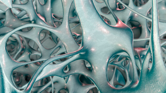 Can an Intraosseous BMC Injection Mend a Non-healing Bone? - Regenexx