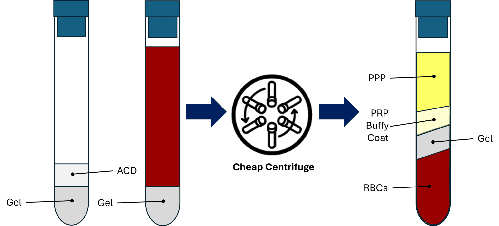 The Great PRP Gel Tube Caper - Regenexx