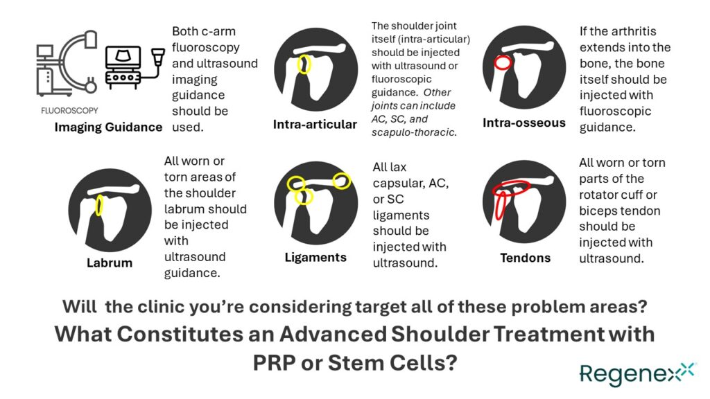 Getting Your Shoulder Injected - Regenexx