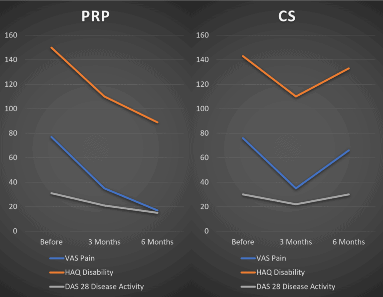 Can PRP Help Rheumatoid Arthritis Patients? - Regenexx