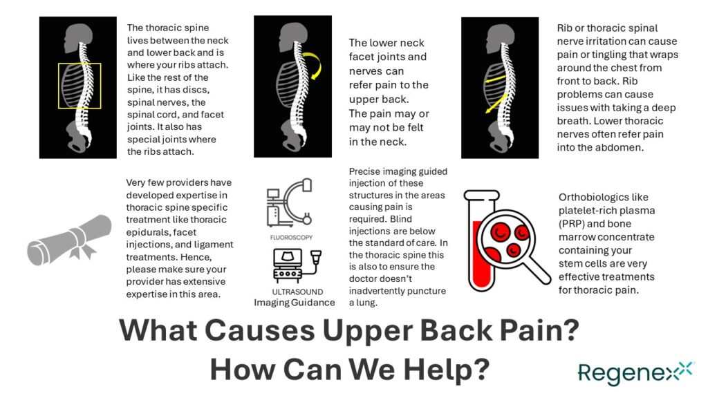 Can You Treat Thoracic Pain with Orthobiologics? - Regenexx