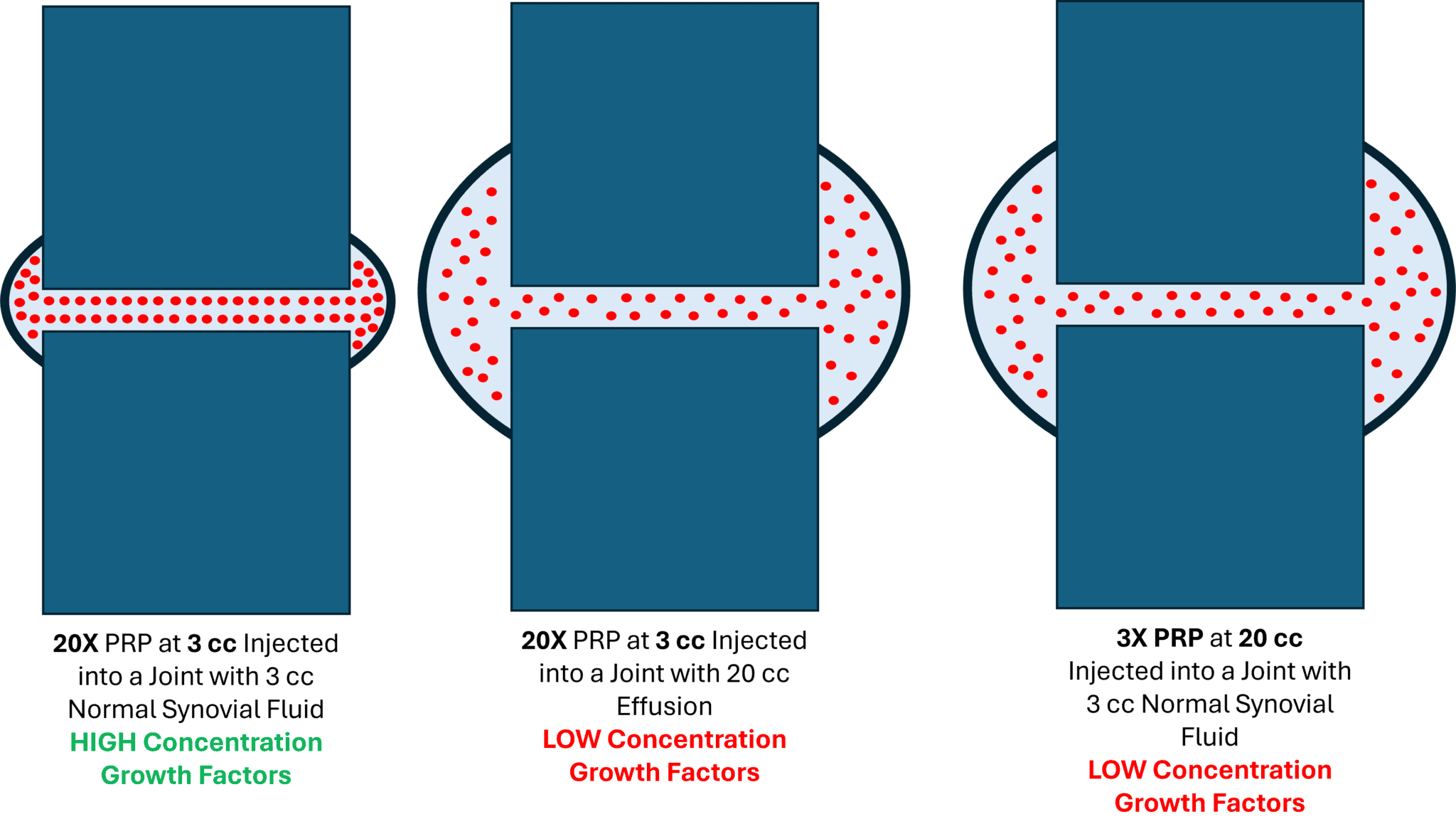 PRP Concentration vs. Dose: Why Concentration Is as Important as Dose ...