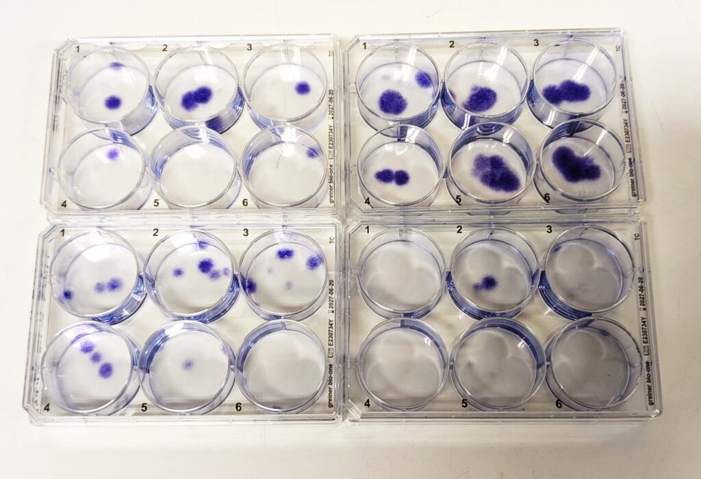 Research Updates on the Bedside Dosing of Bone Marrow Concentrate ...
