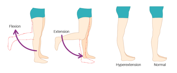 Hyperflexion Of The Knee: Causes, Symptoms, And Treatment Options